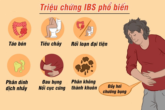 Tổng hợp các triệu chứng dễ nhận biết nhất khi mắc bệnh đại tràng